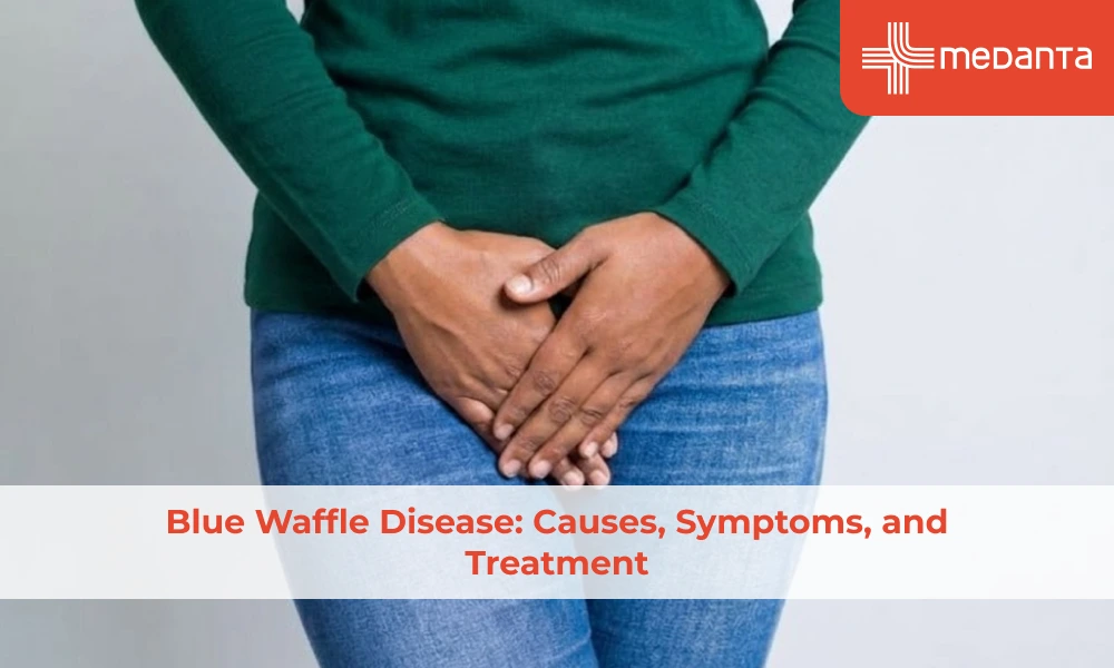 Blue Waffle Disease Causes Symptoms And Treatment